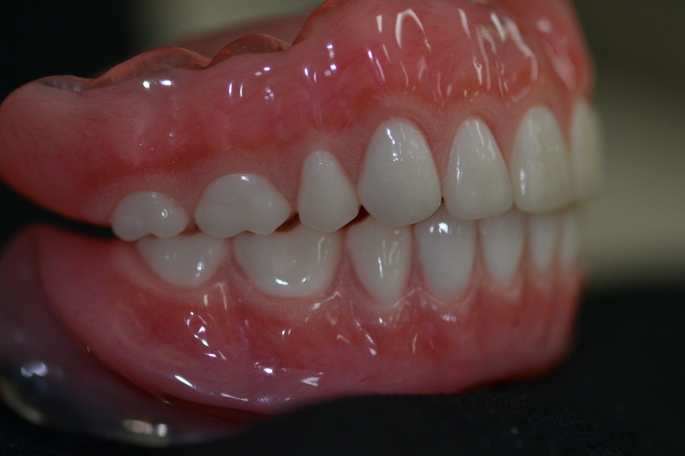 Prothèses complètes | Clinique mon denturo